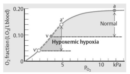 Hipoksia merupakan kondisi dimana darah tidak mamp...