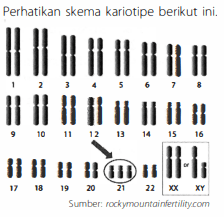 Perhatikan skema kariotipe berikut ini. Kariotipe ...