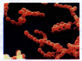 Bakteri Streptococcus memiliki ciri utama .... A....