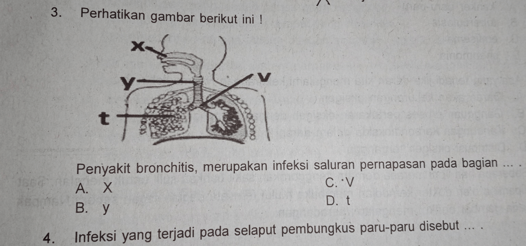 Perhatikan gambar berikut ini ! Penyakit bronchit...