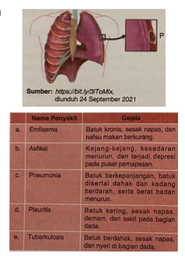 pasangan yang sesuai antara nama penyakit yang dap...