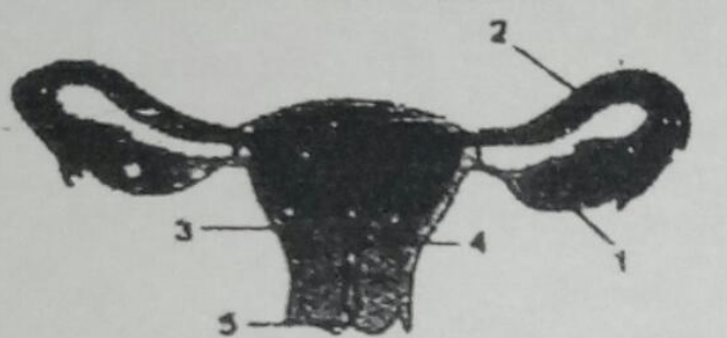 Urutan organ pada gambar adalah.... A. ovarium, tu...