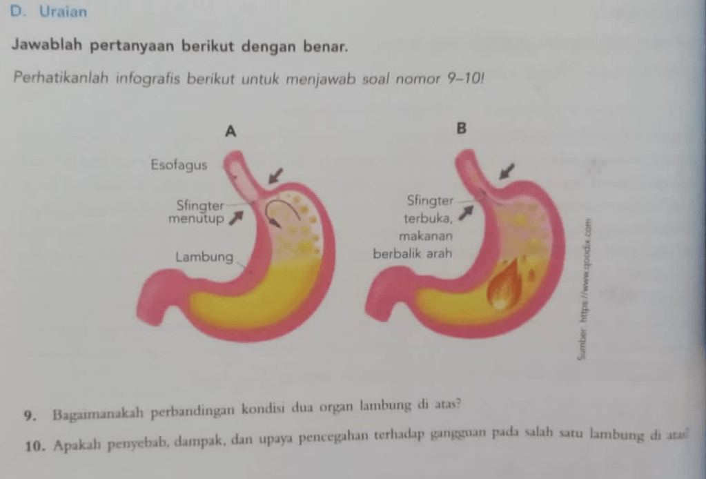 9. Bagaimanakah perbandingan kondisi dua organ lam...