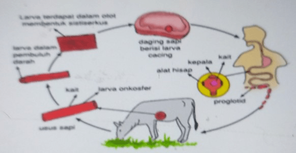 Perhatikan gambar berikut. Bentuk infeksi Taenia v...