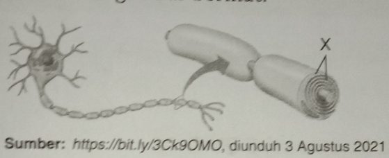 Perhatikan gambar berikut! Penyakit autoimunitas ...