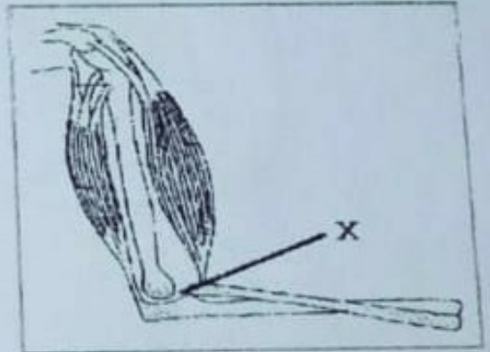 Perhatikan gambar di samping. Jenis sendi dan ar...