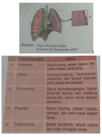Pasangan yang sesuai antara nama penyakit yang dap...