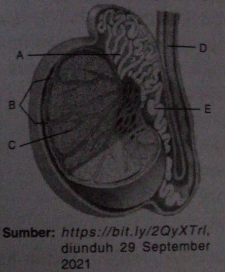 perhatikan gambar struktur testis berikut! bagia...